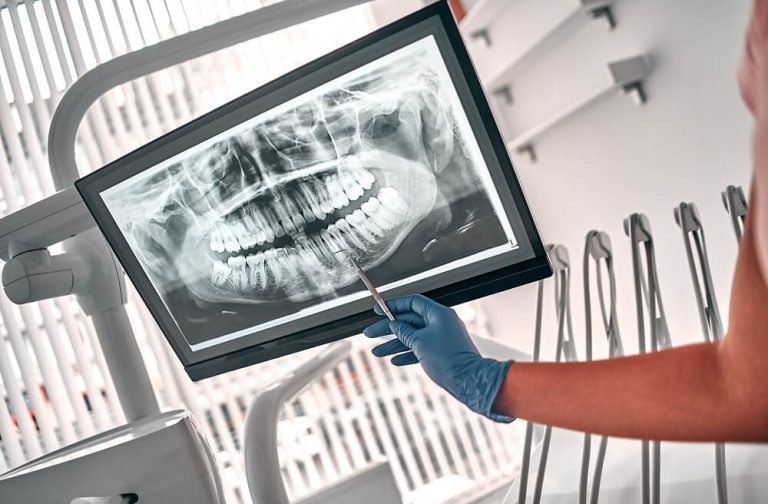 Dentista periodontista: tudo sobre a especialidade odontológica