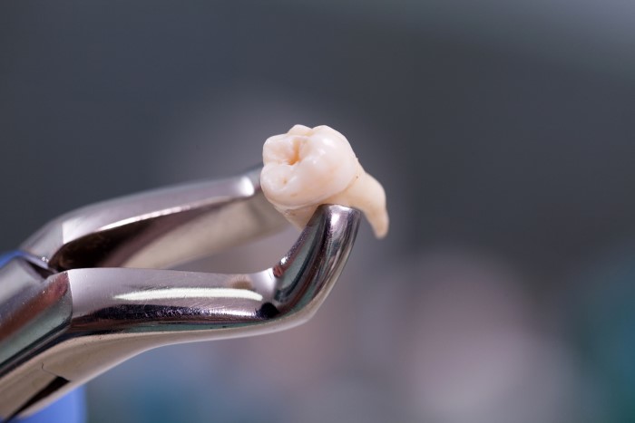 Banco de dentes humanos: o que é e qual a importância?