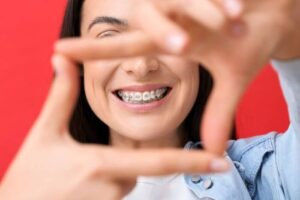 Overjet e overbite: entendendo o significado de más oclusões